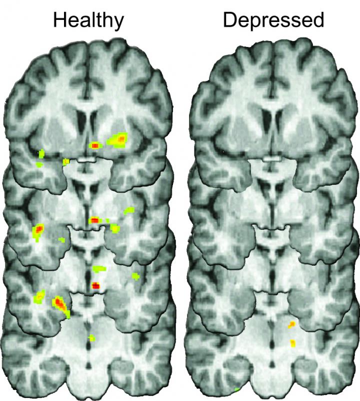 Rejection's Effect on a Depres [IMAGE] | EurekAlert! Science News Releases