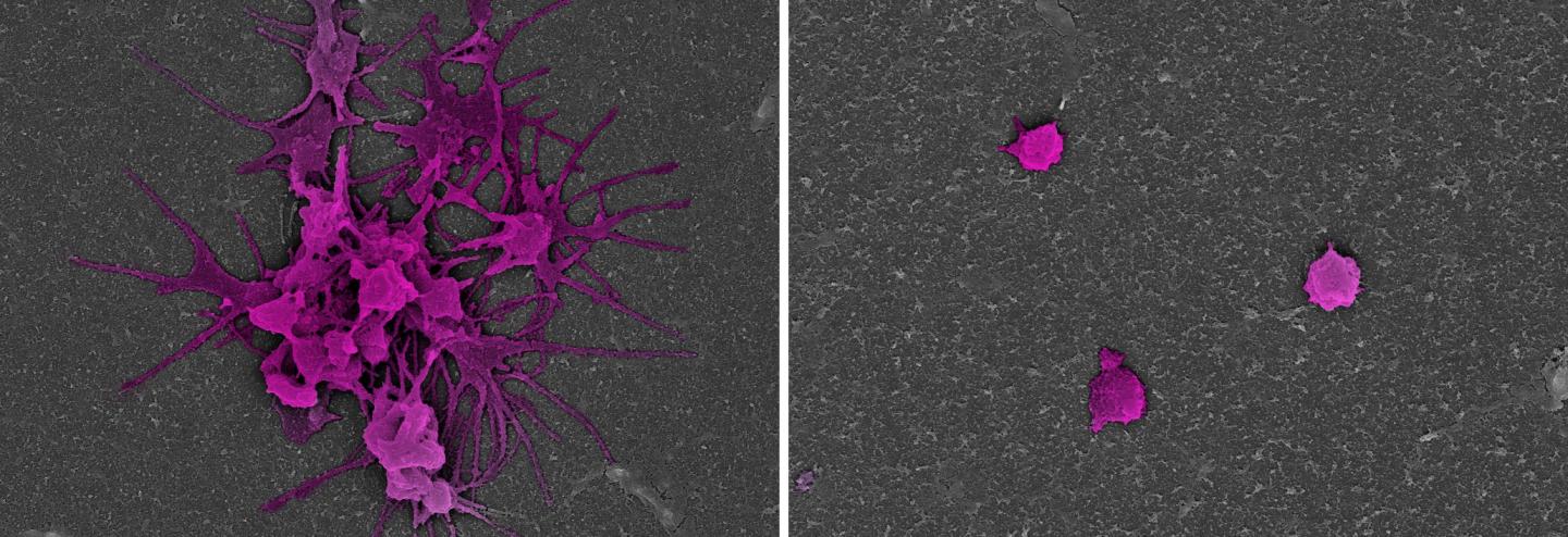 Platelet Doppelgängers Ta [IMAGE] | EurekAlert! Science News Releases