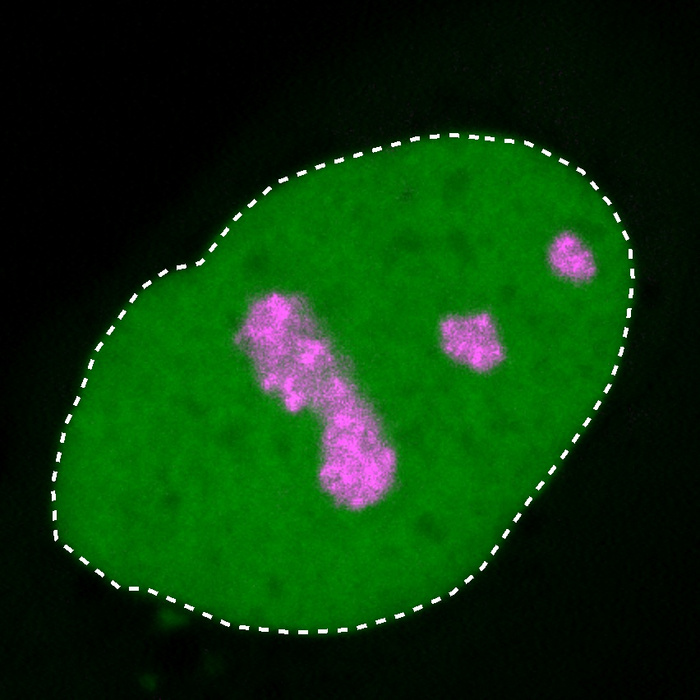 Nucleus of a healthy human cel [IMAGE] | EurekAlert! Science News Releases
