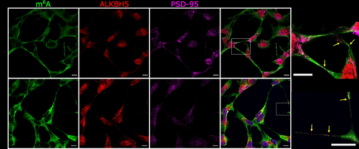 Demethylation of RNA messages [IMAGE] | EurekAlert! Science News Releases