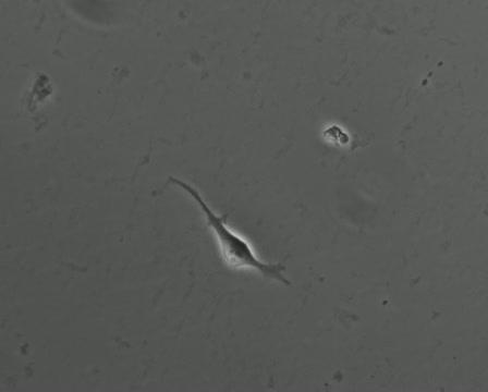 How stem cells move | EurekAlert!