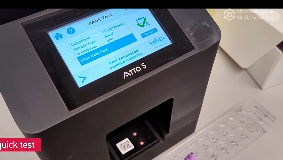 SMART and NTU Singapore develop a quick test | EurekAlert!