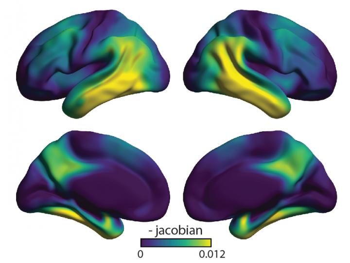 Harmful Protein Buildup Predicts Brain Atroph | EurekAlert!