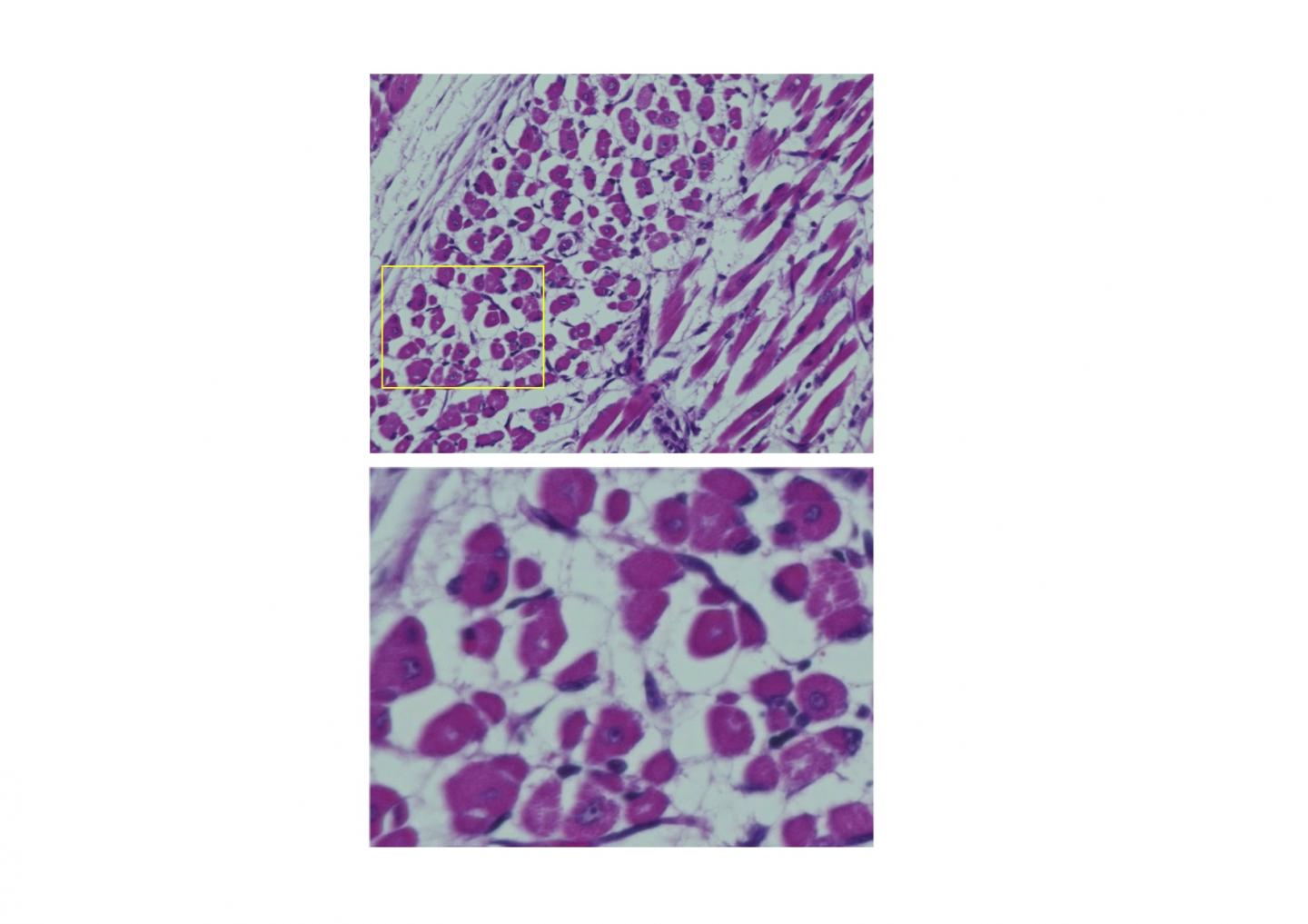 Abnormal Muscle Phenotype Obse [IMAGE] | EurekAlert! Science News Releases