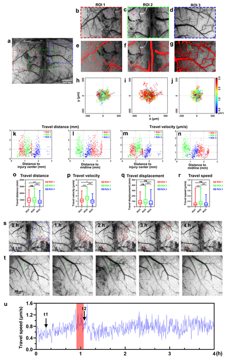TIS window for bilateral corti [IMAGE] | EurekAlert! Science News Releases