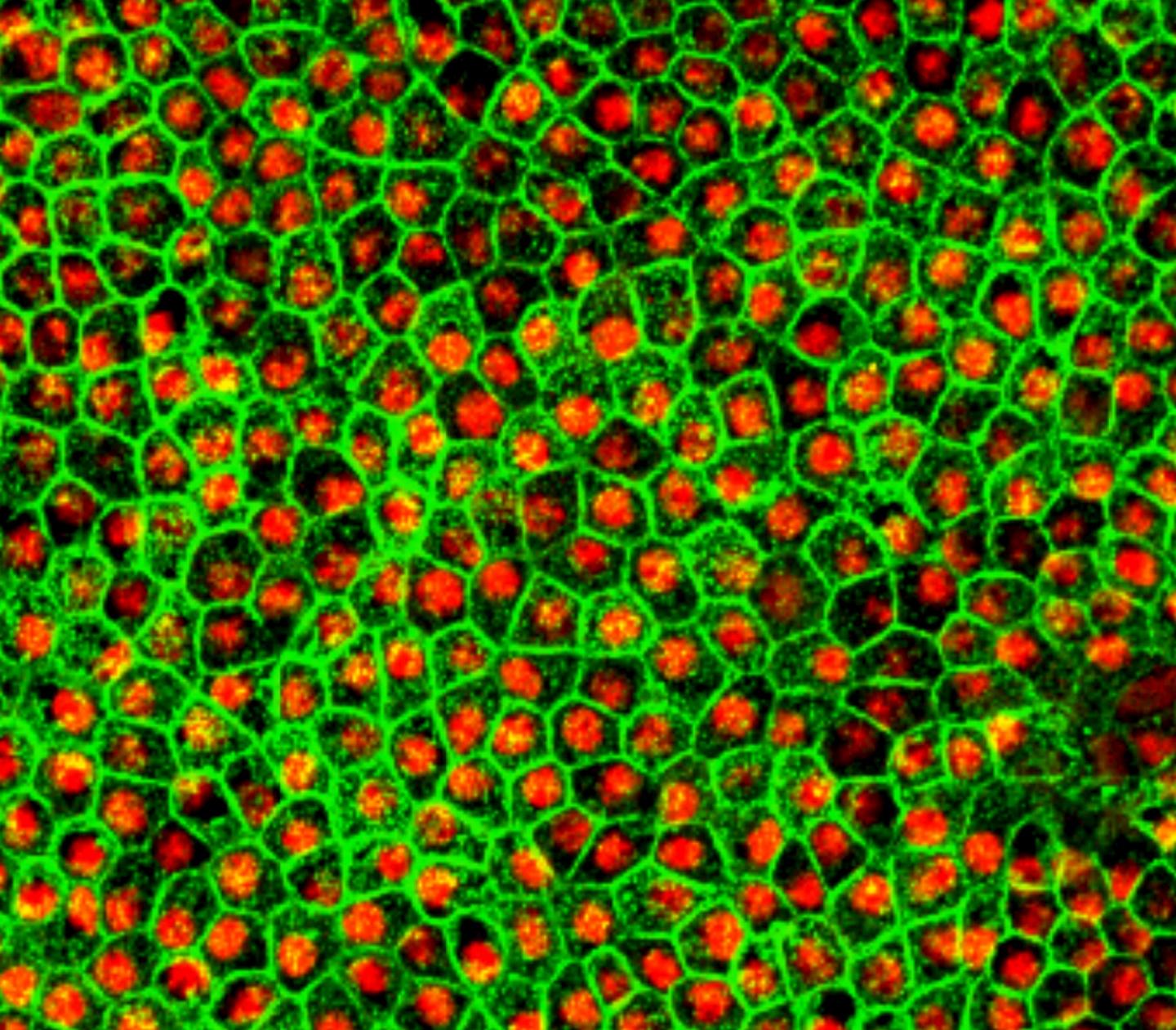 RPE cells [IMAGE] | EurekAlert! Science News Releases