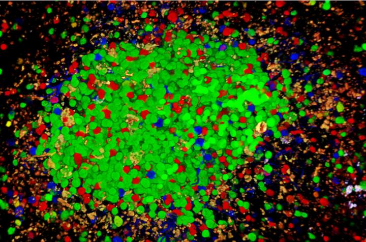 B Cells Battle Each Other [IMAGE] | EurekAlert! Science News Releases