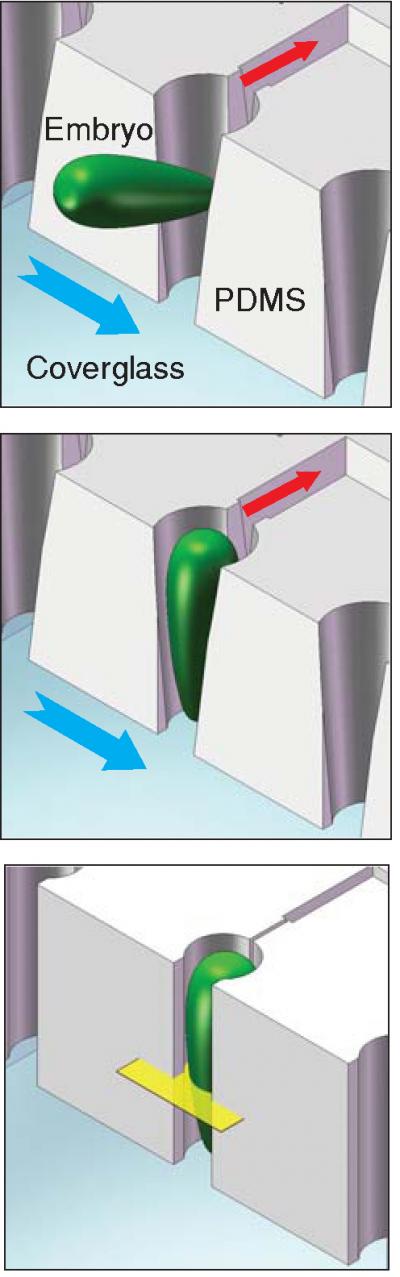 Microfluidic Device Trapping P [IMAGE] | EurekAlert! Science News Releases