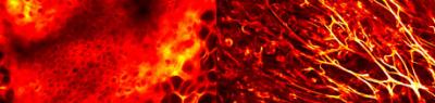 2-Photon Microscopy [IMAGE] | EurekAlert! Science News Releases