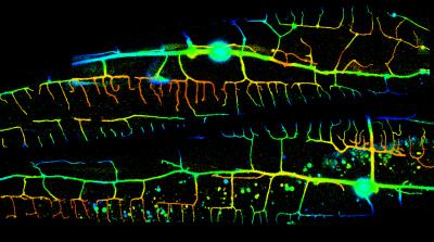 Pruning Neuronal Trees (5 of 6) | EurekAlert!