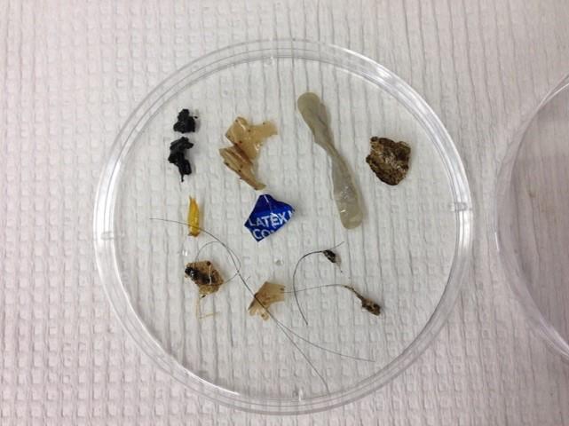 Microplastics in Rivers [IMAGE] | EurekAlert! Science News Releases