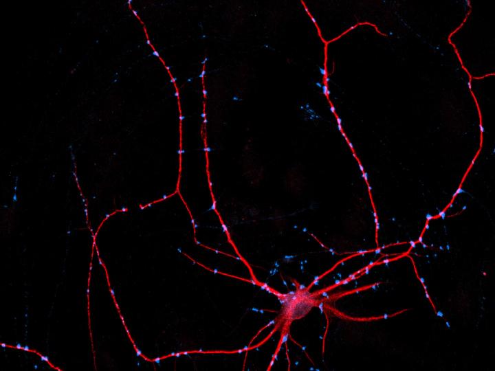 Image of a 'Single' Neuron [IMAGE] | EurekAlert! Science News Releases