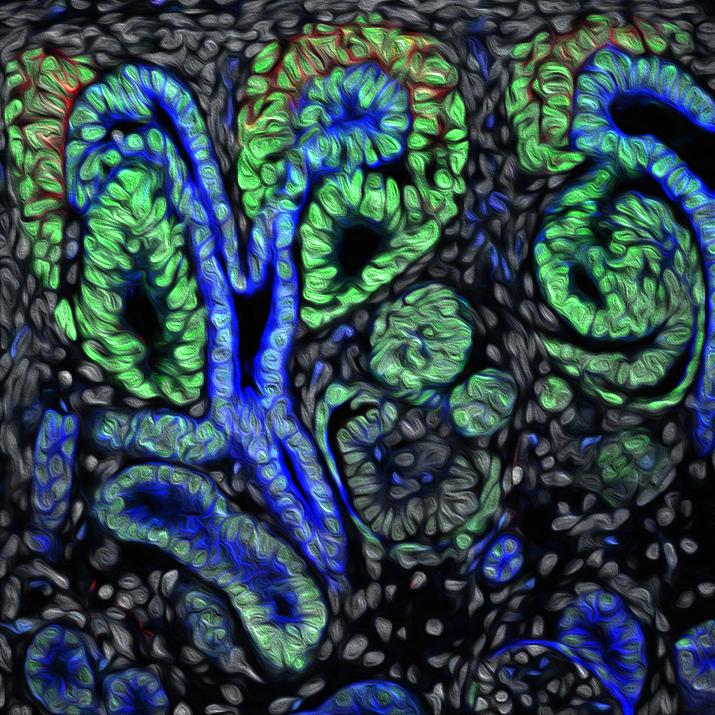 Kidney Stem Cells [IMAGE] | EurekAlert! Science News Releases