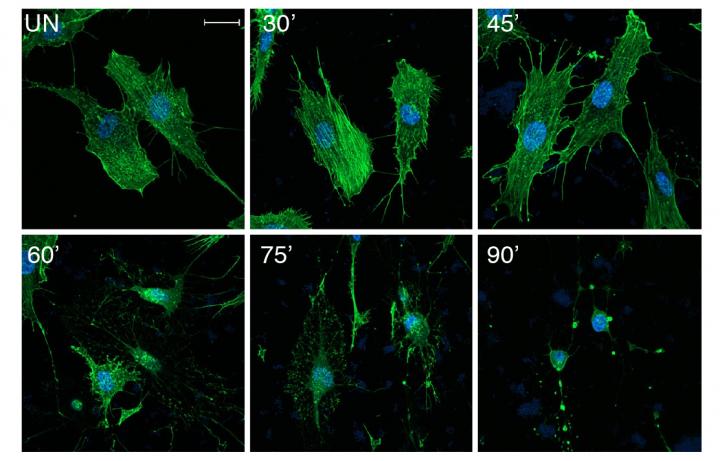 Revealing how a Pathogen Rewires Host Cells | EurekAlert!