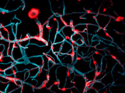 The Long Arms of Pericytes [IMAGE] | EurekAlert! Science News Releases