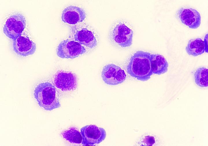 AML Cell Lines Expressing MLL- [IMAGE] | EurekAlert! Science News Releases
