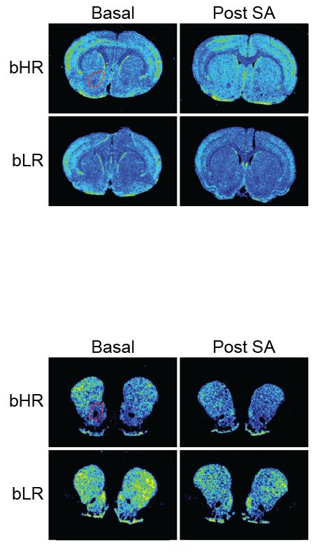 Who gets hooked on drugs? Rat study finds gen | EurekAlert!