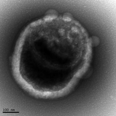 Single Cell [IMAGE] | EurekAlert! Science News Releases