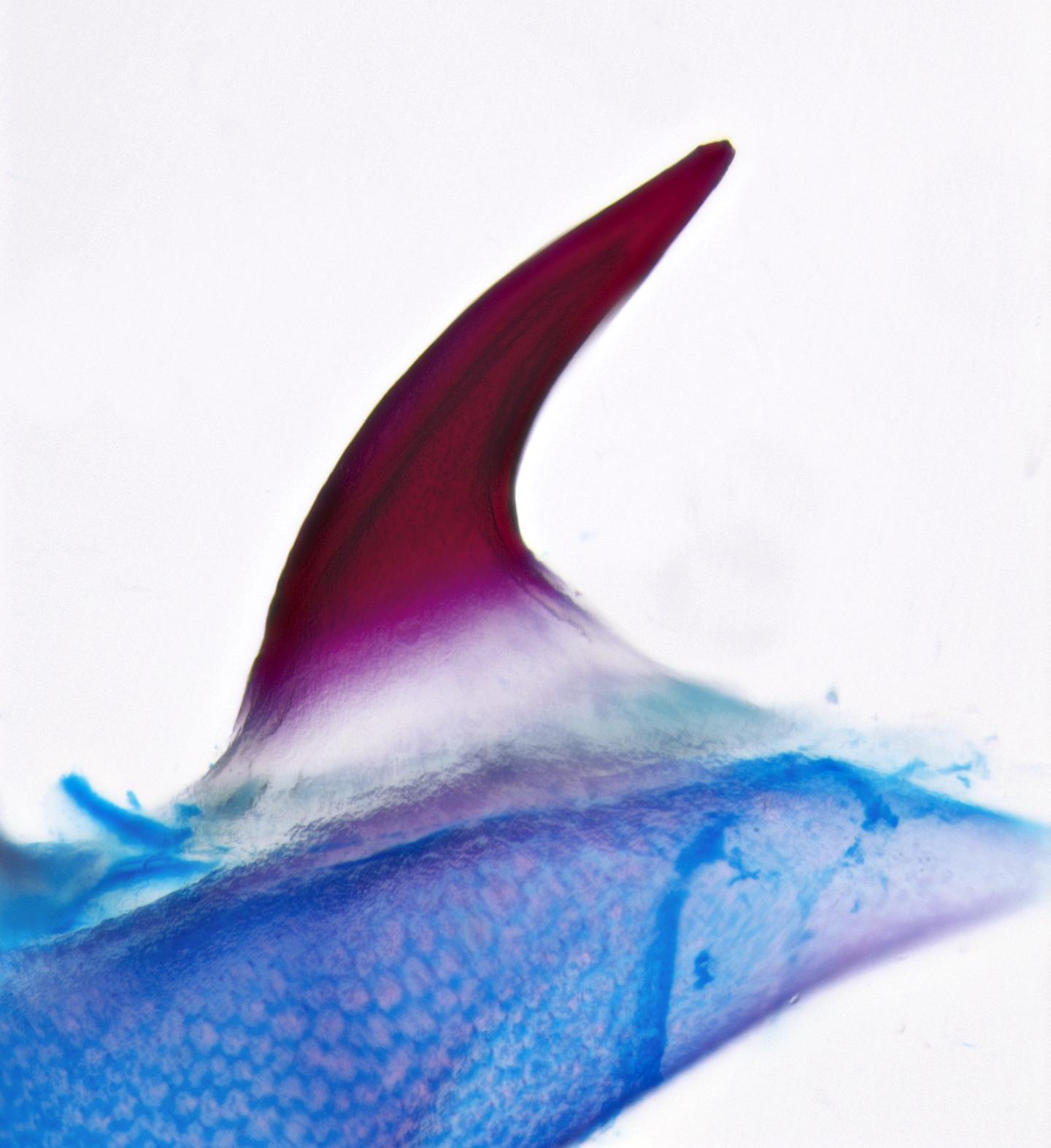 A Single Dermal Denticle [IMAGE] | EurekAlert! Science News Releases