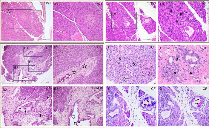 Representative histological se [IMAGE] | EurekAlert! Science News Releases