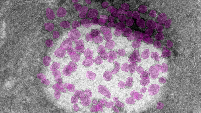 Release of vesicles [IMAGE] | EurekAlert! Science News Releases