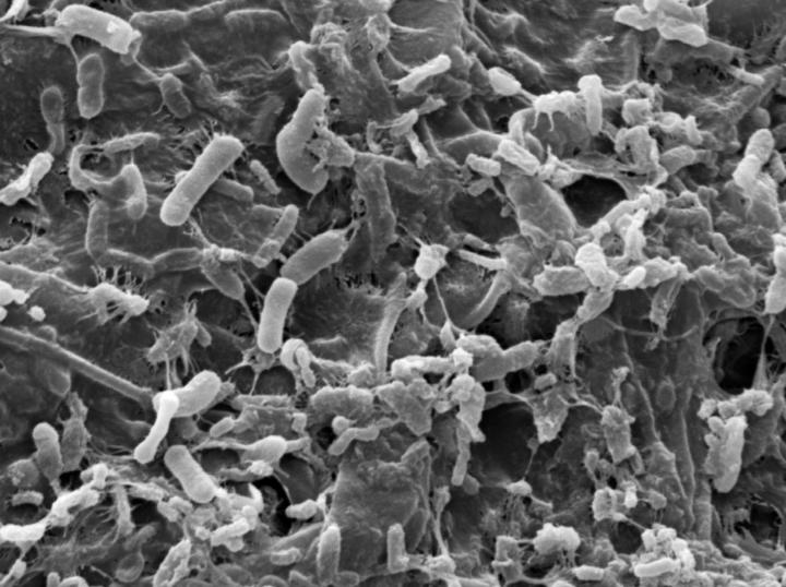 Soil Microbes [IMAGE] | EurekAlert! Science News Releases