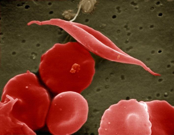 Red Blood Cell Electron Microscope