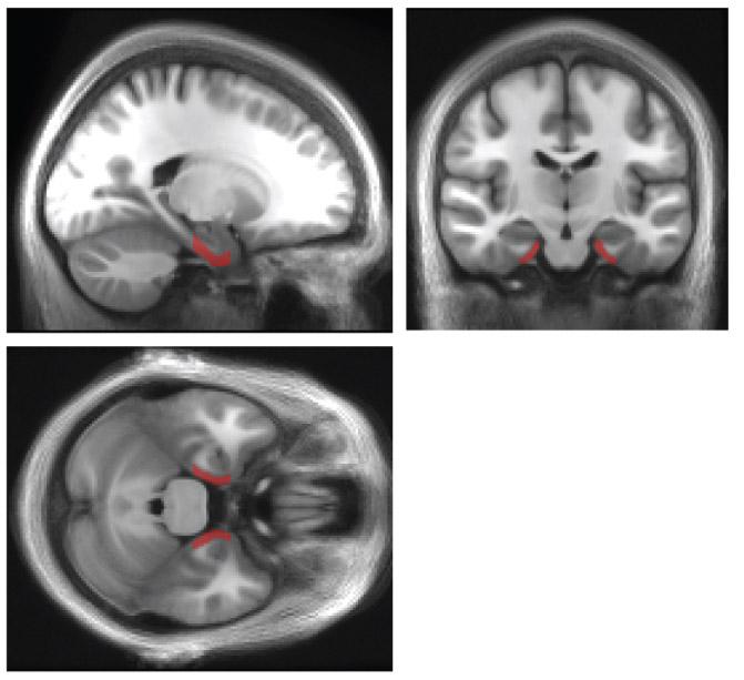 Entorhinal Cortex From 3 Views [IMAGE] | EurekAlert! Science News Releases