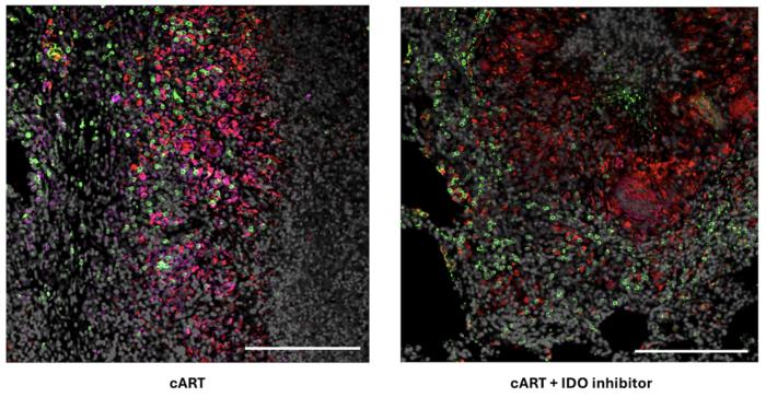IDO inhibitor w/ TB SIV [IMAGE] | EurekAlert! Science News Releases