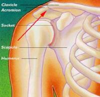 Healing a shoulder separation | EurekAlert!