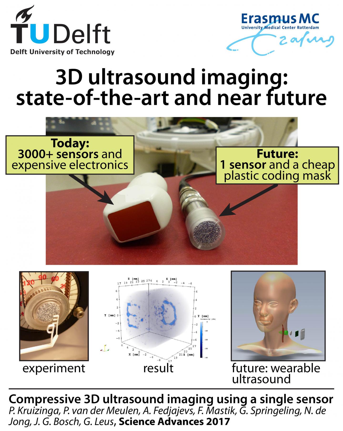 One Sensor, Instead of Thousands, for 3-D Ult | EurekAlert!