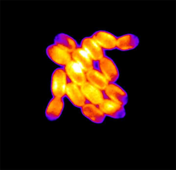 Even Bacteria Need Their Space Squished Cells May Shut Down