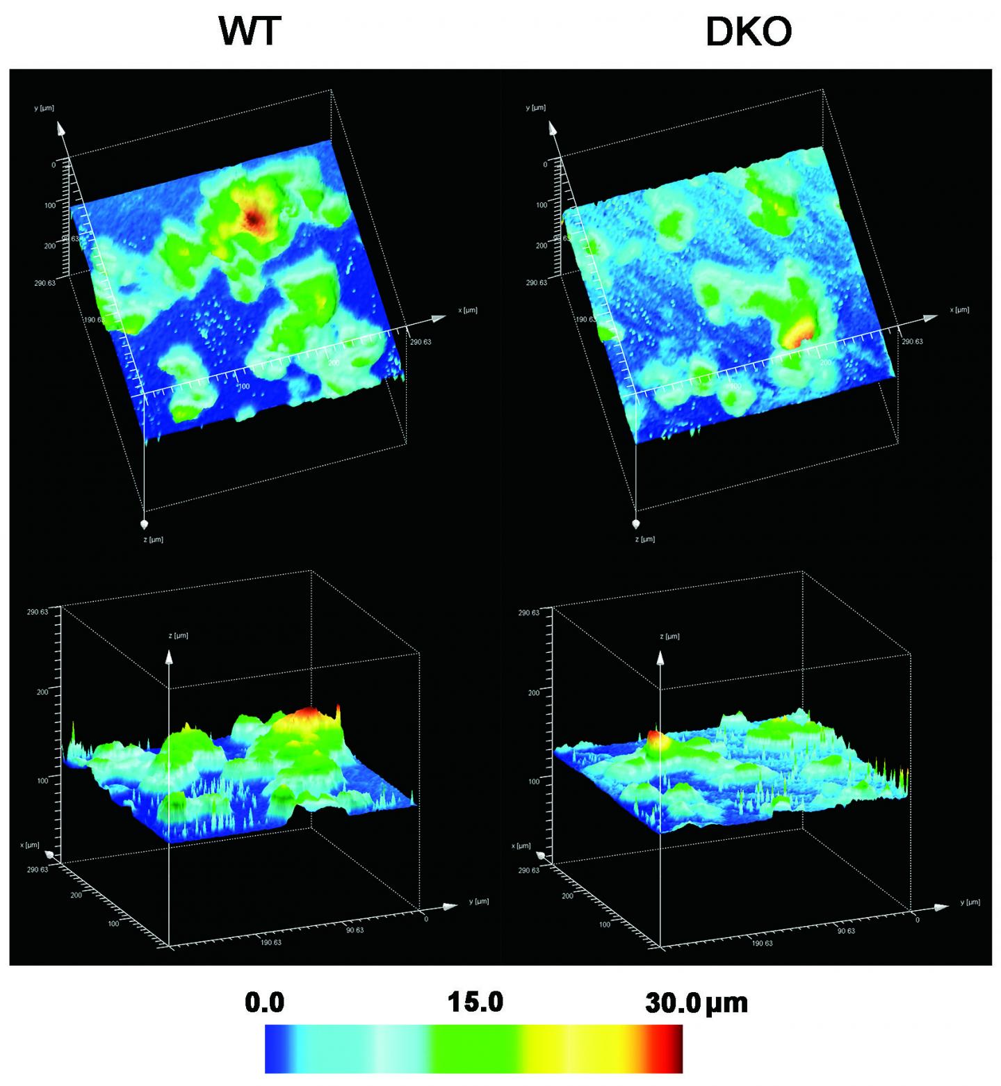 Hampering Bone Breakdown Prote [IMAGE] | EurekAlert! Science News Releases