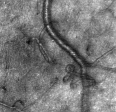 Retinal Capillary [IMAGE] | EurekAlert! Science News Releases