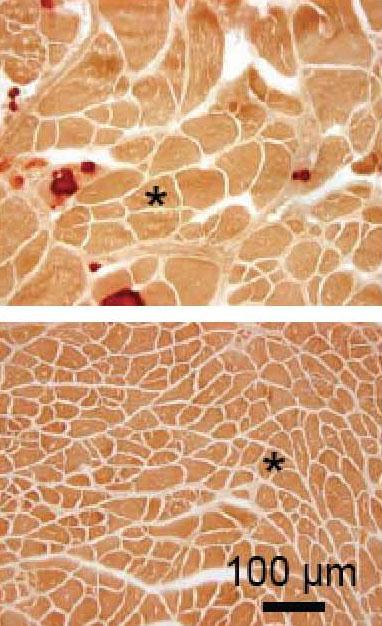 Gene transfer corrects severe muscle defects | EurekAlert!