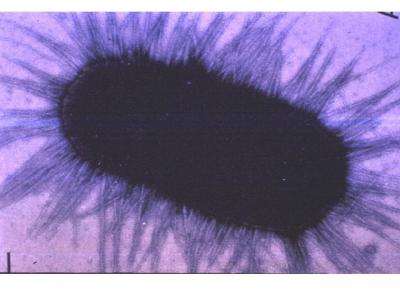 Proteus mirabilis [IMAGE] | EurekAlert! Science News Releases