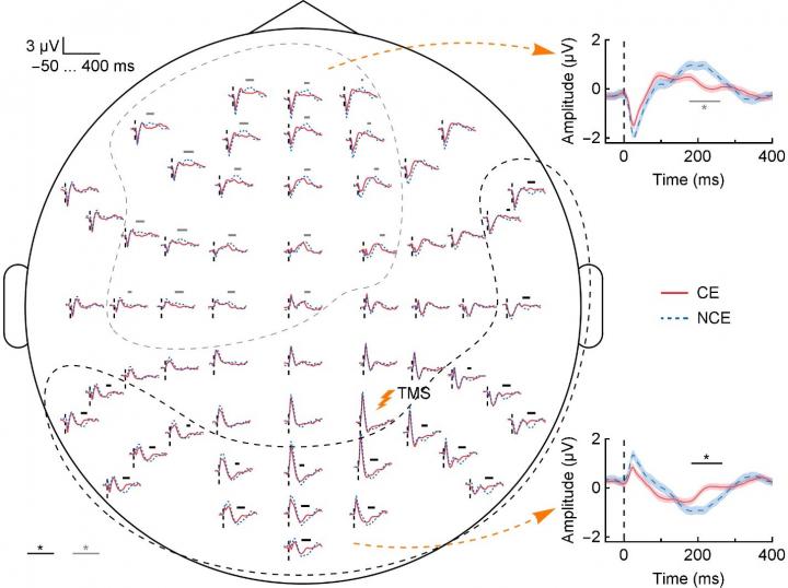 TMS-EEG (2 of 2) [IMAGE] | EurekAlert! Science News Releases
