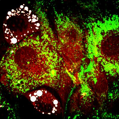 Fat Storage in Cells [IMAGE] | EurekAlert! Science News Releases