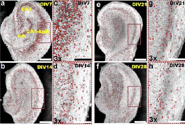 Representative Optical Coheren [IMAGE] | EurekAlert! Science News Releases