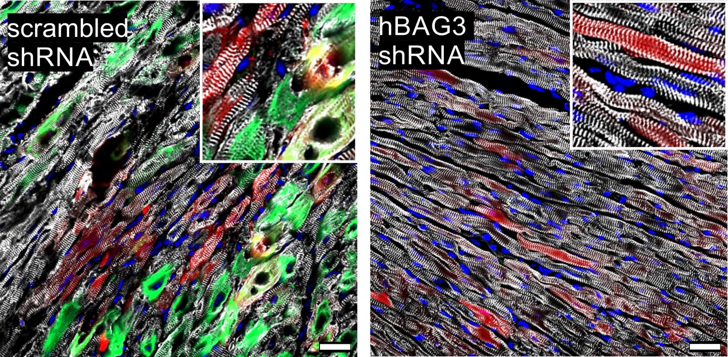 Experimental therapy [IMAGE] | EurekAlert! Science News Releases