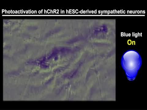 Lab-grown nerve cells make heart cells throb | EurekAlert!