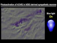 Lab-grown nerve cells make heart cells throb | EurekAlert!