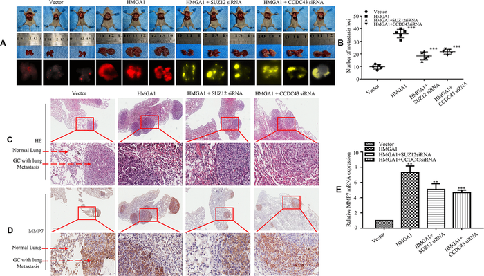 Aging-US: HMGA1 promotes gastric cancer growt | EurekAlert!