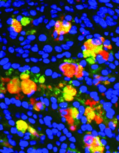 FAS-Deficient Mice [IMAGE] | EurekAlert! Science News Releases