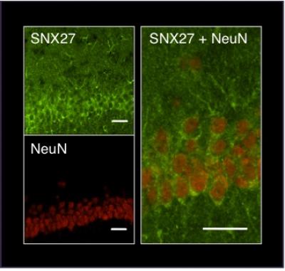 SNX27 Expression in Hippocampa [IMAGE] | EurekAlert! Science News Releases