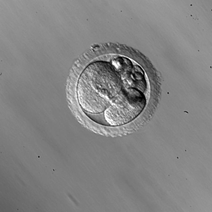 Rhesus Embryo Cellular Fragmen [IMAGE] | EurekAlert! Science News Releases