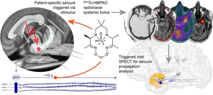 New method for triggering and imaging seizure | EurekAlert!