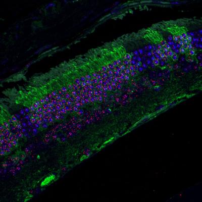 Eye of Chimeric Mice [IMAGE] | EurekAlert! Science News Releases