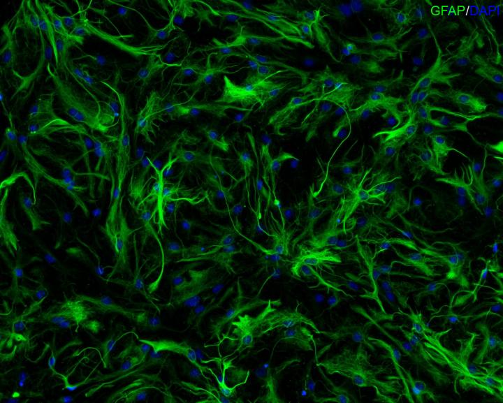 Astrocytes [IMAGE] | EurekAlert! Science News Releases