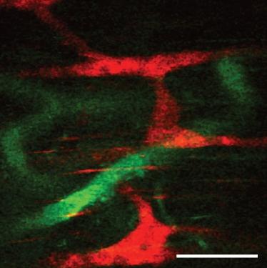 Enteric Photo [IMAGE] | EurekAlert! Science News Releases